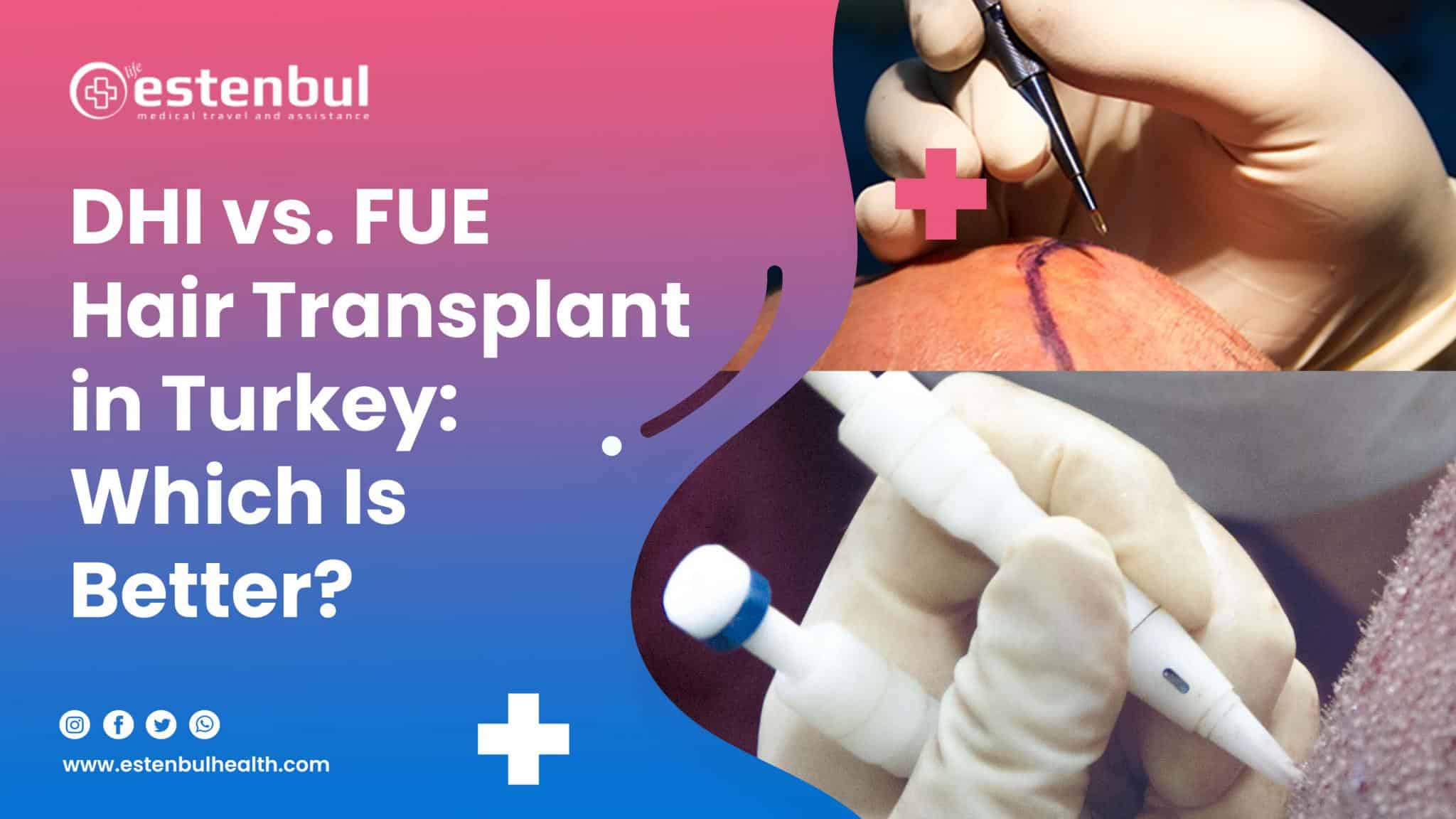 DHI vs FUE Hair Transplant in Turkey 2026: Which Is Better?