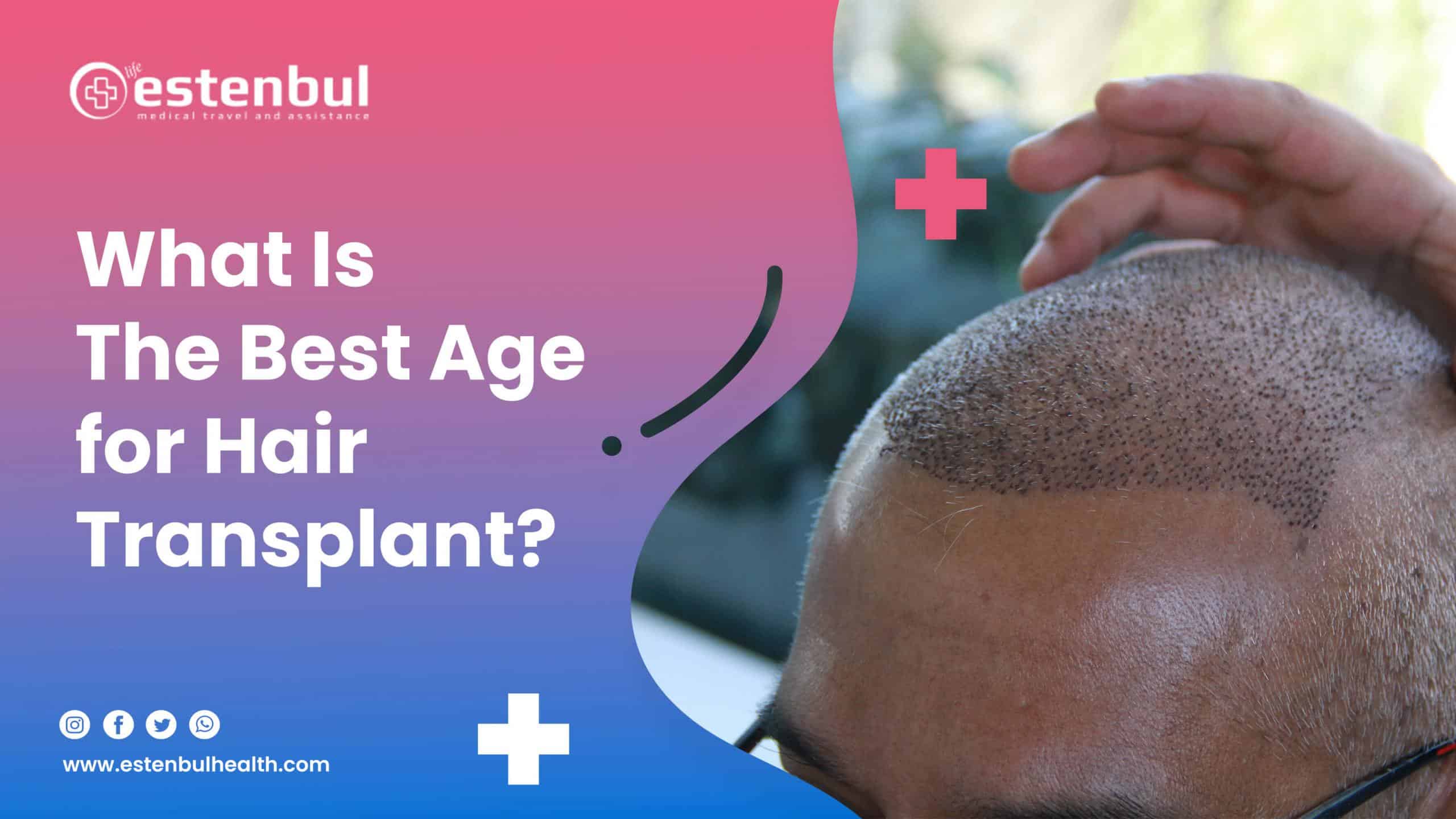What Is The Best Age For Hair Transplant Estenbul Health What Is The Best Age For Hair Transplant Estenbul Health