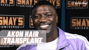 Akon Spent 7,500 Dollars on Hair Transplant in Turkey | Estenbul Health