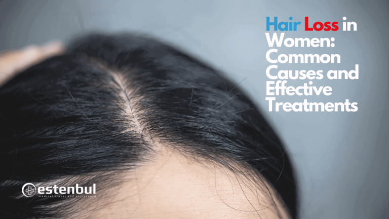 Hair Loss in Women: Common Causes and Effective Treatments | Estenbul ...