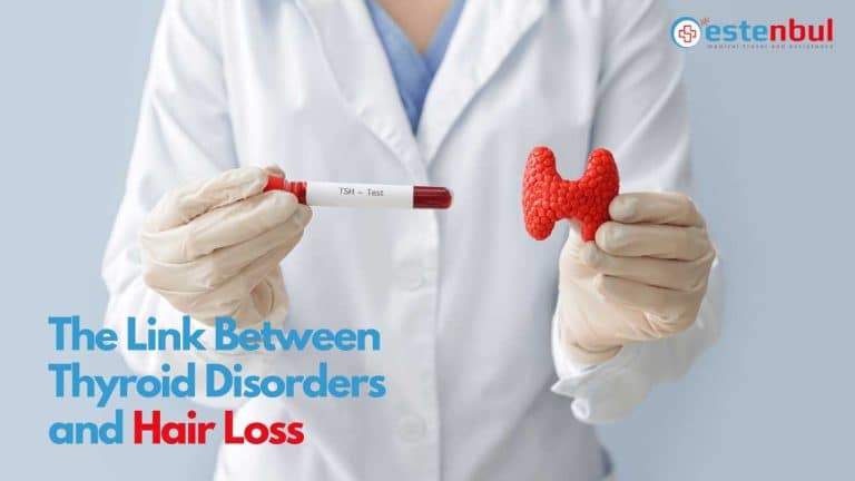 The Link Between Thyroid Disorders and Hair Loss | Estenbul Health
